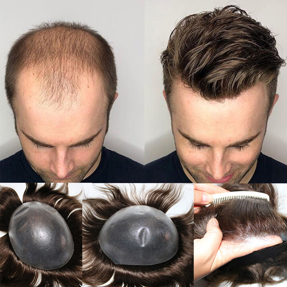 Hair Pieces for Men: Discover the Most Natural-Looking Solutions